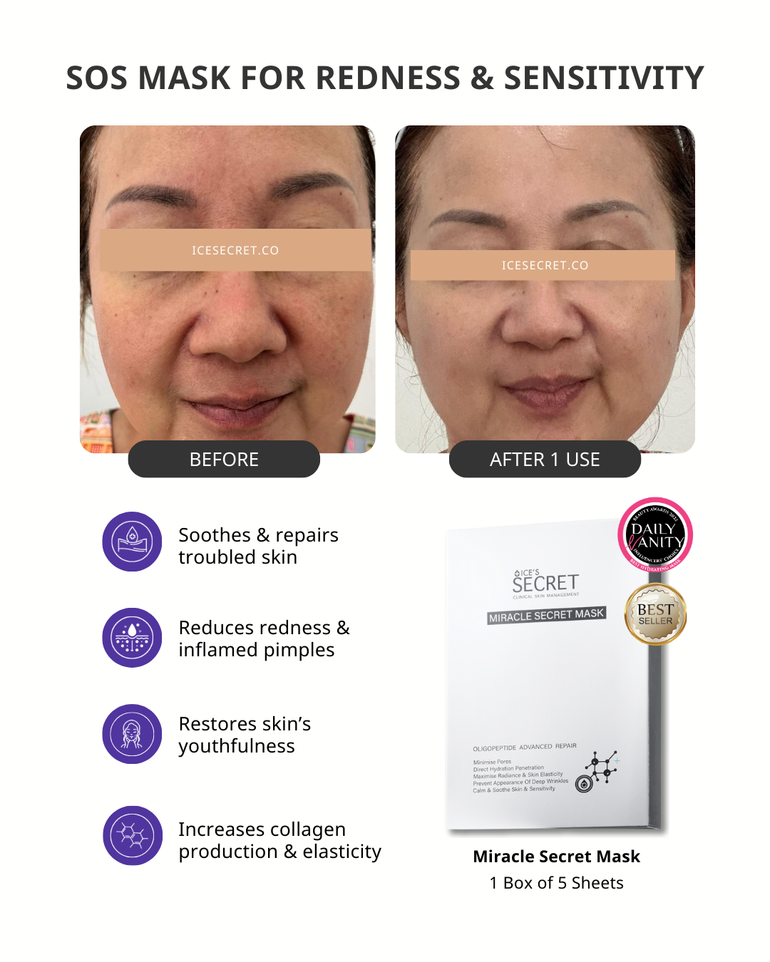 Skincare – Ice Secret