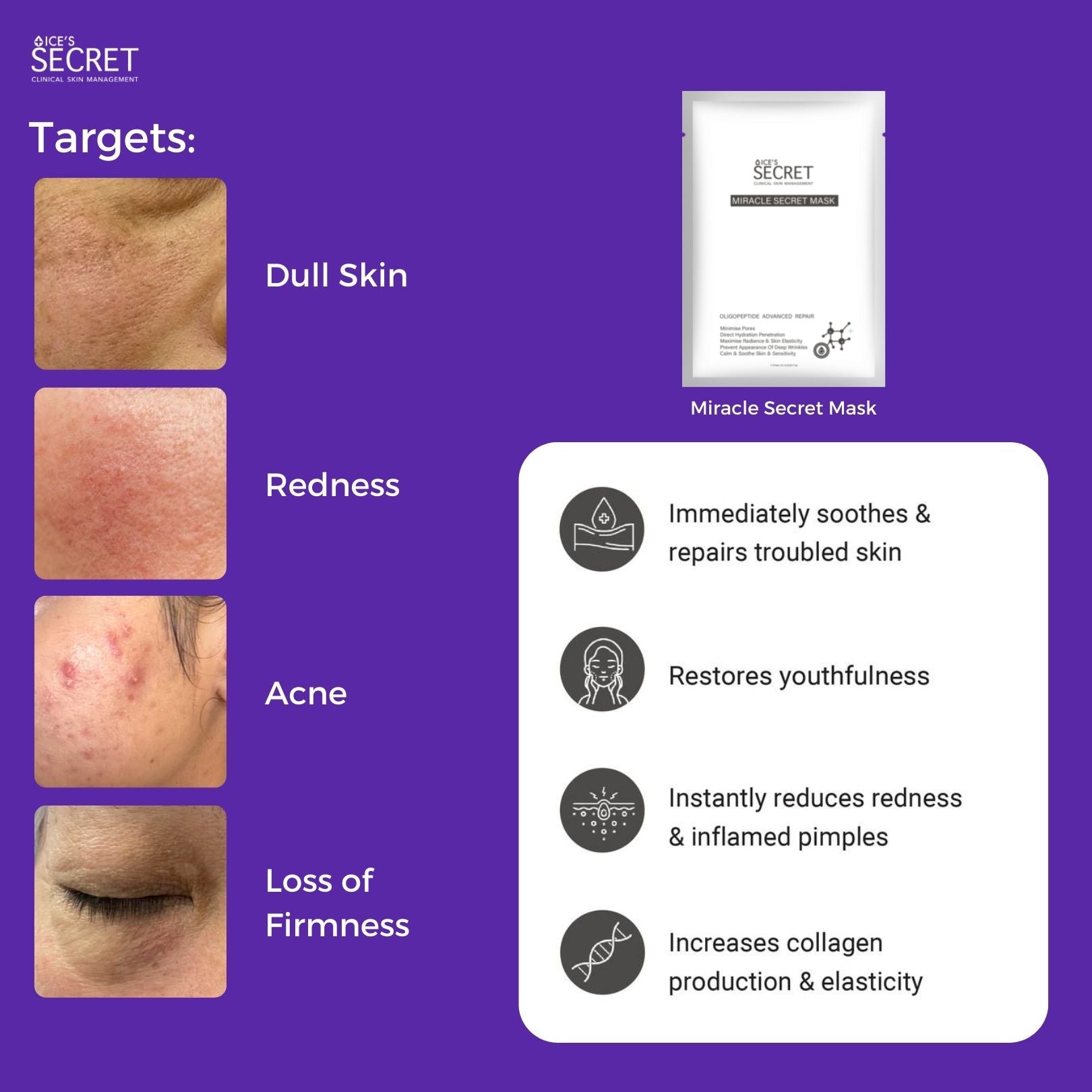 Miracle Secret Mask - Oligopeptide Skincare – Ice's Secret