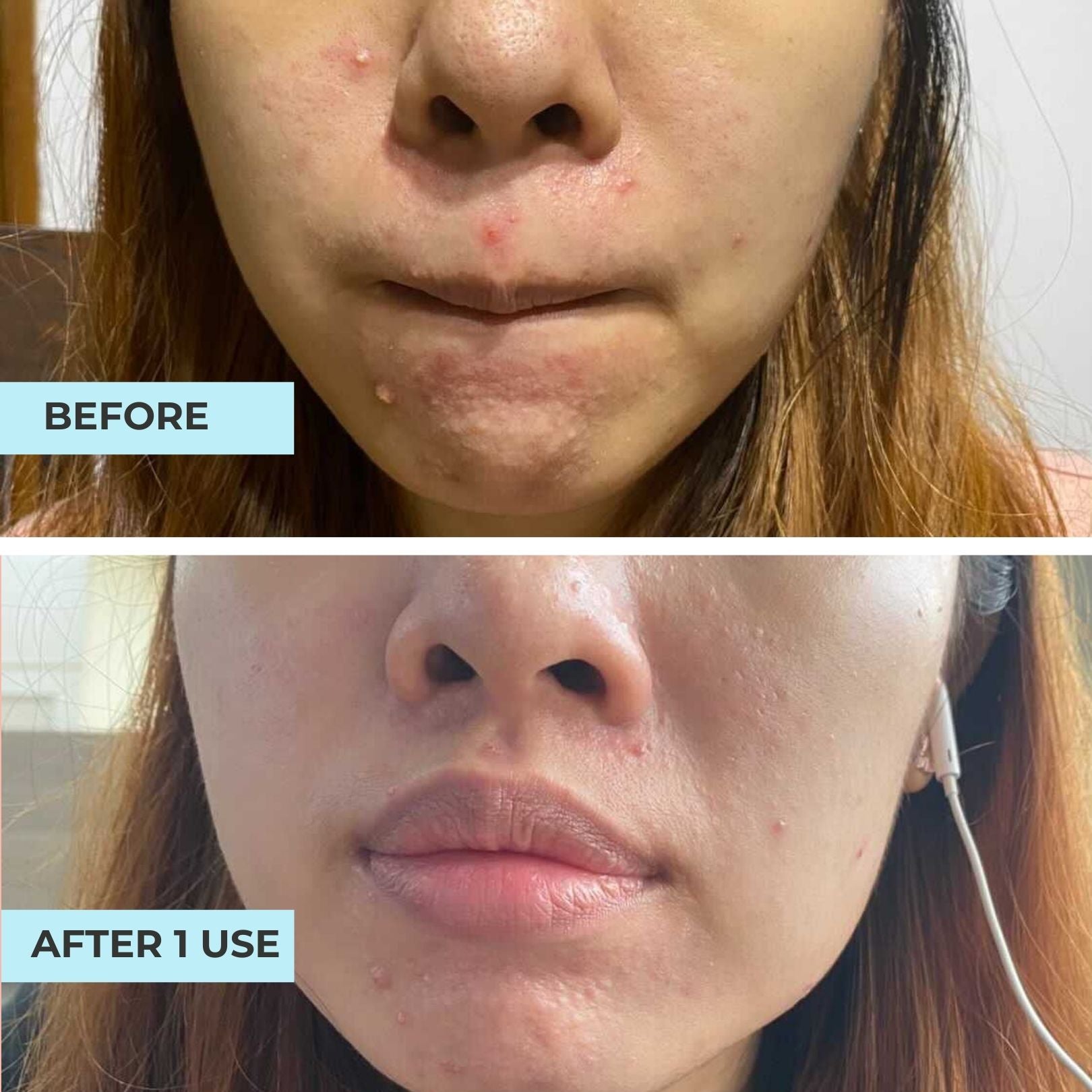 Miracle Secret Mask - Oligopeptide Skincare – Ice's Secret